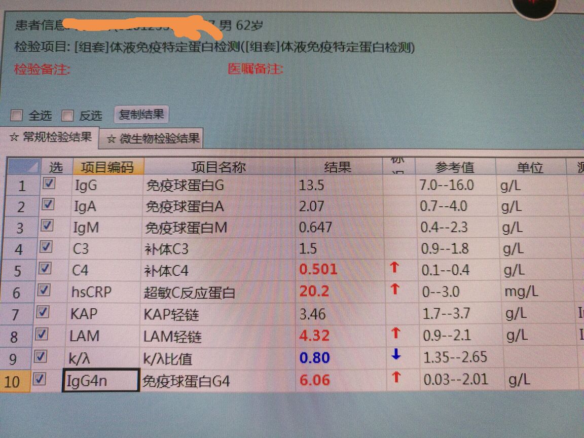 IgG4相关性疾病一例